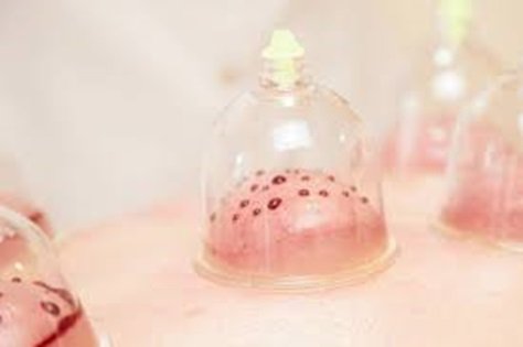 Panacea Point - Acupuncture and Laser Clinic