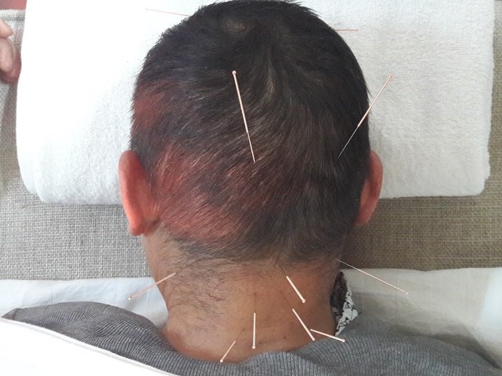 Panacea Point - Acupuncture and Laser Clinic