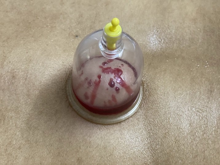 Panacea Point - Acupuncture and Laser Clinic