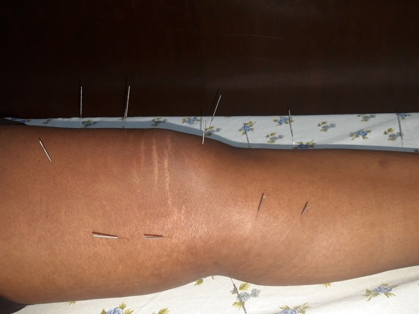 Panacea Point - Acupuncture and Laser Clinic