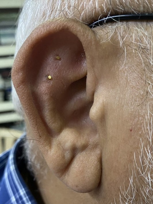 Panacea Point - Acupuncture and Laser Clinic