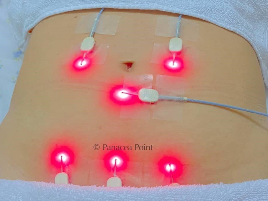 Panacea Point - Acupuncture and Laser Clinic