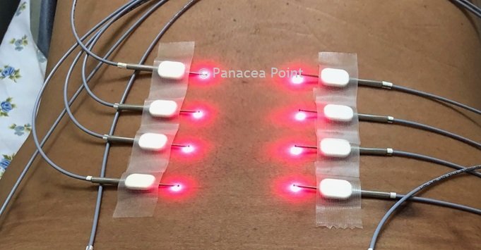 Panacea Point - Acupuncture and Laser Clinic